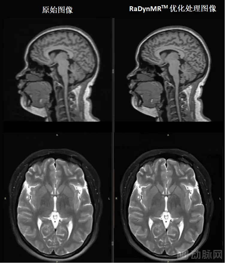 专访影动医疗创始人龚南杰：打造全球领先的AI医学影像技术-动脉网