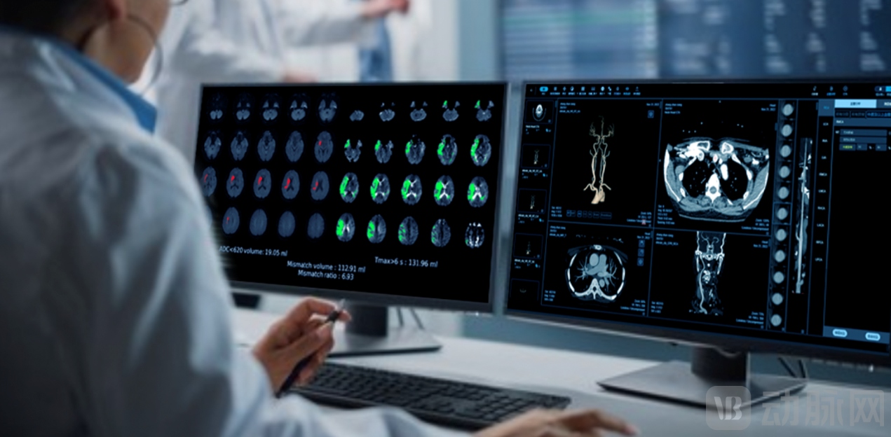 【首发】医未AI卒中获批NMPA三类证丨中国唯一在AD及卒中领域均获三类证的企业医药新闻-ByDrug-一站式医药资源共享中心-医药魔方