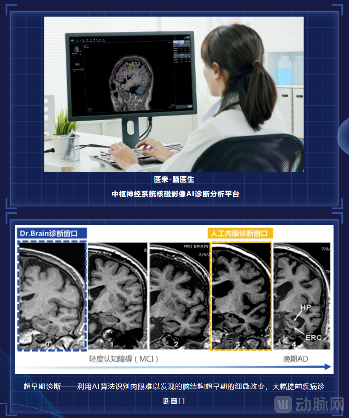 【首发】医未AI卒中获批NMPA三类证丨中国唯一在AD及卒中领域均获三类证的企业医药新闻-ByDrug-一站式医药资源共享中心-医药魔方