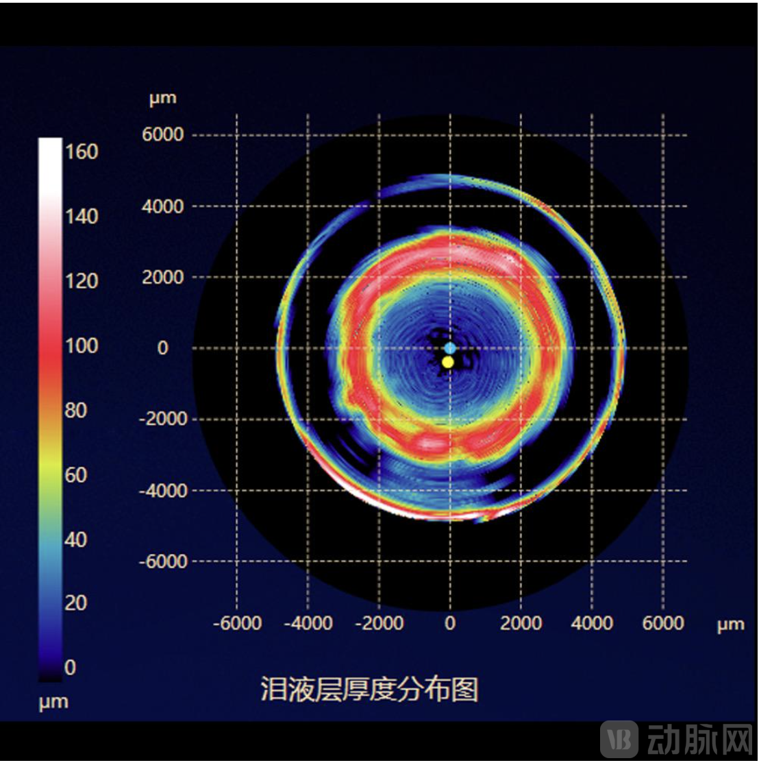 率先突破！唯仁医疗创新智能OCT引导角膜塑形镜数字化精准验配系统医药新闻-ByDrug-一站式医药资源共享中心-医药魔方