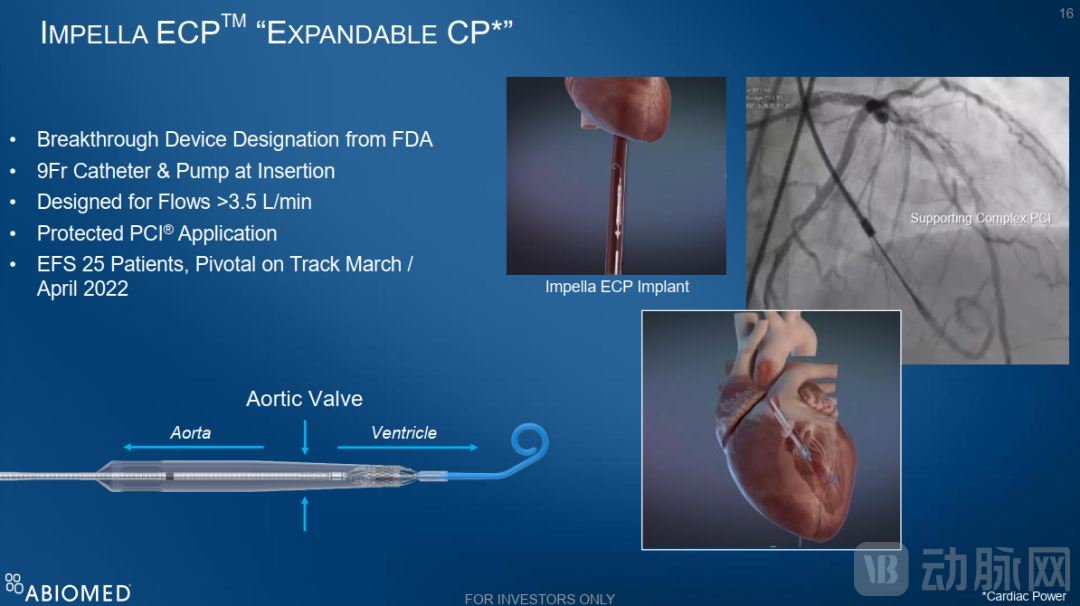 介入式人工心脏：更大流量、更长支持时间 vs 更小的介入尺寸 -动脉网